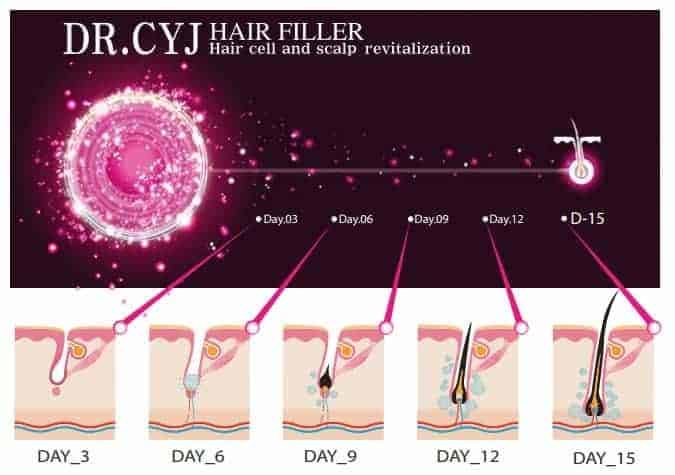 Dr Cyj Hair Filler sposób na wypadające włosy? | La Guèl Warszawa